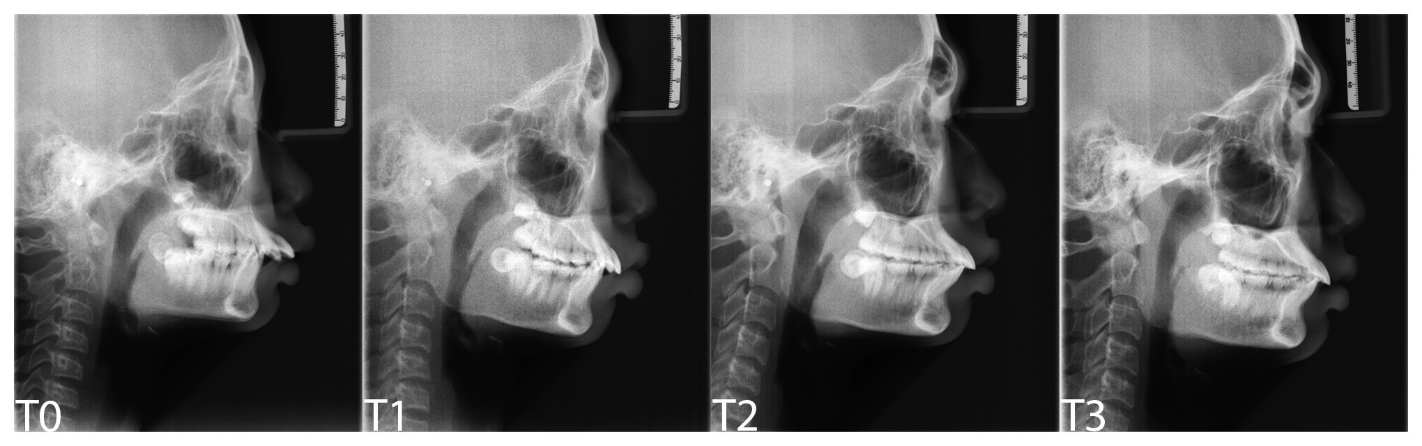 Journal of Clinical Pediatric Dentistry (JOCPD)