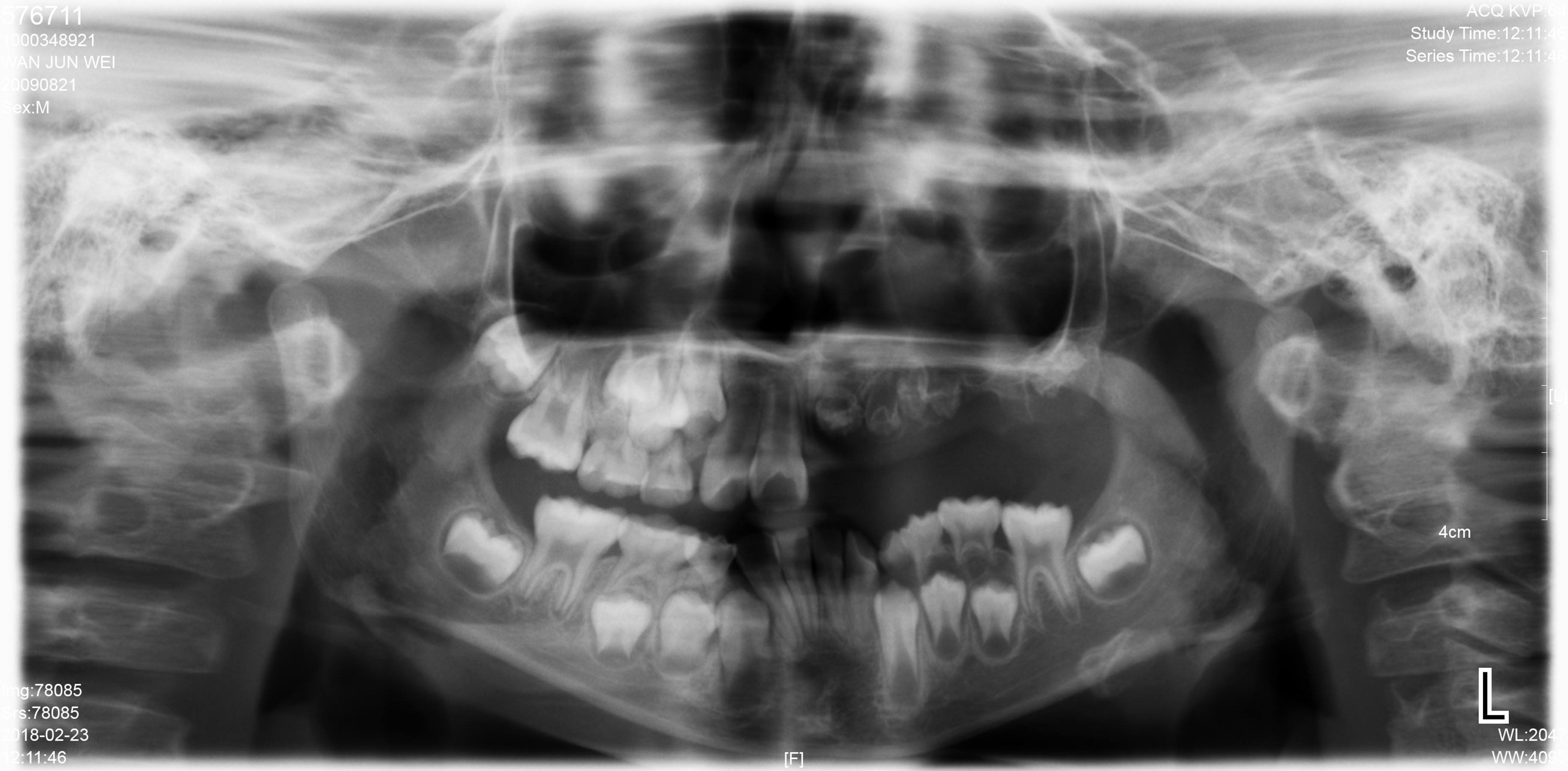 Journal of Clinical Pediatric Dentistry (JOCPD)