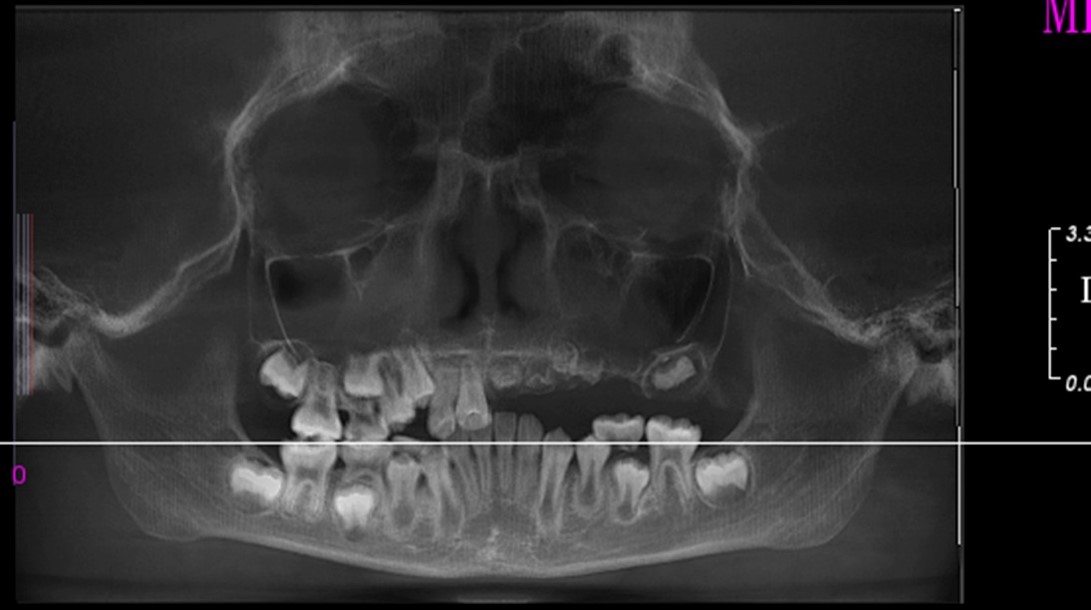 Journal of Clinical Pediatric Dentistry (JOCPD)