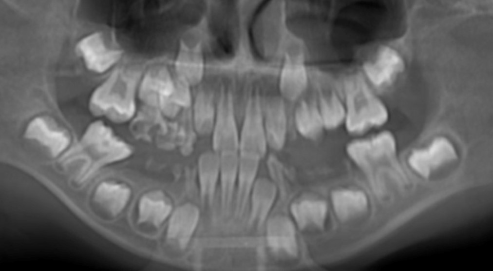 Journal of Clinical Pediatric Dentistry (JOCPD)