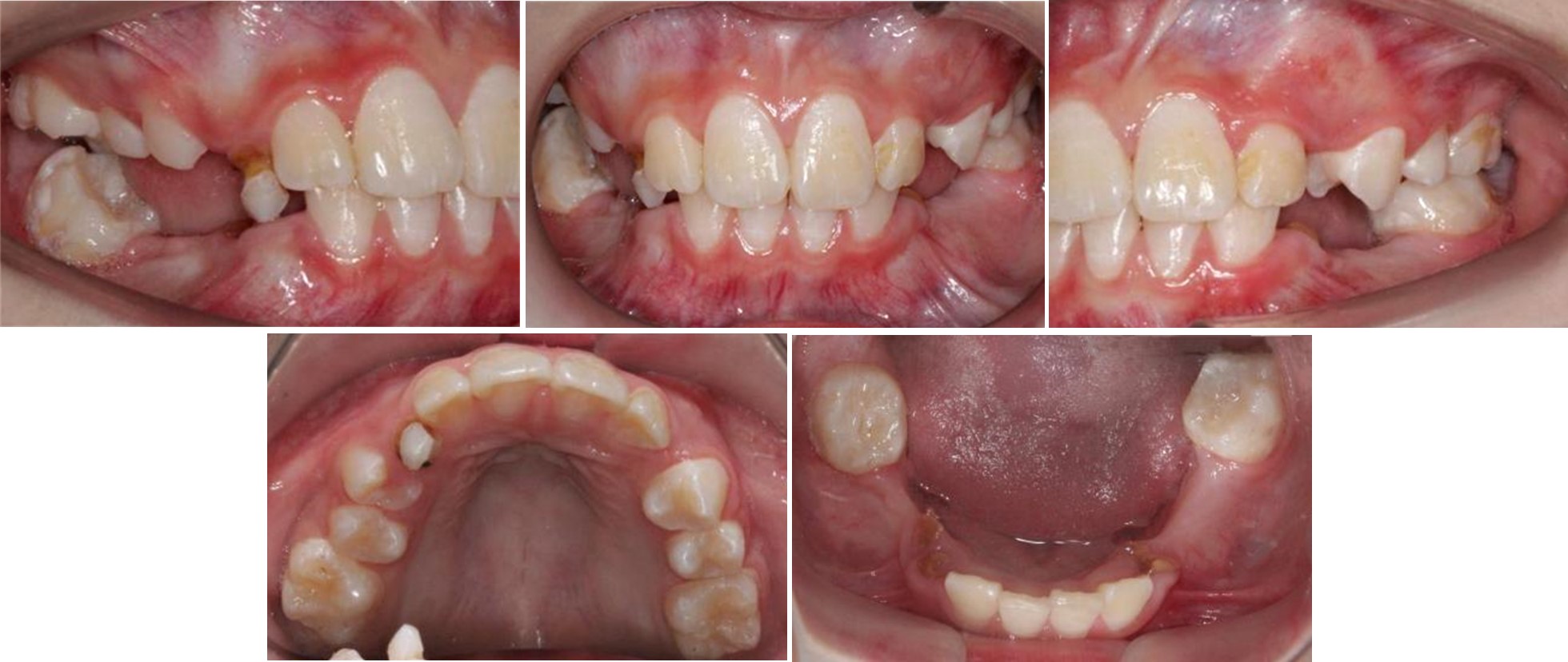 Journal of Clinical Pediatric Dentistry (JOCPD)