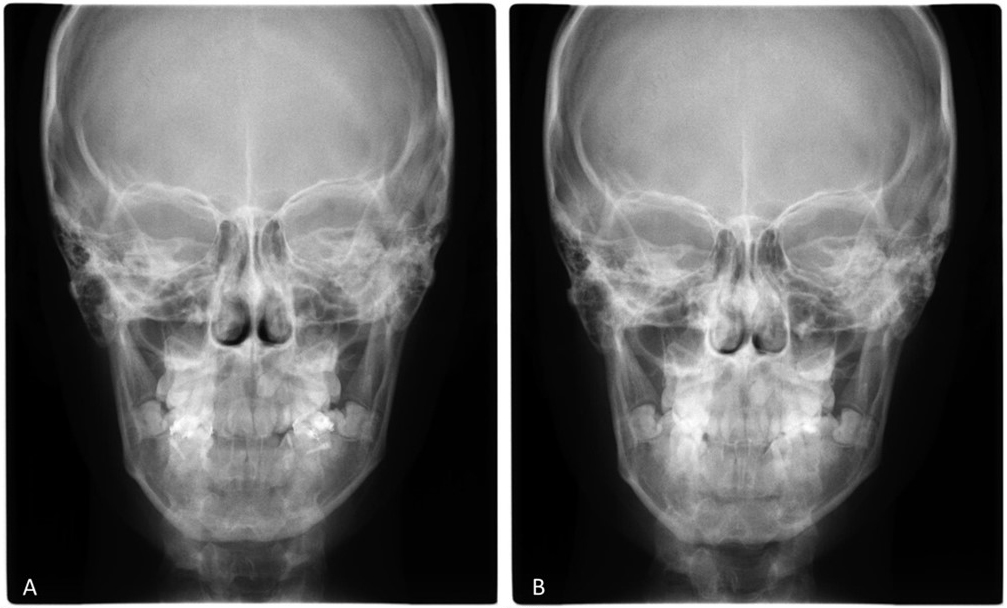 Journal of Clinical Pediatric Dentistry (JOCPD)