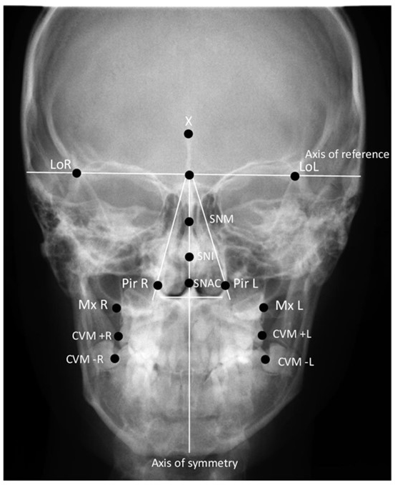 Journal of Clinical Pediatric Dentistry (JOCPD)