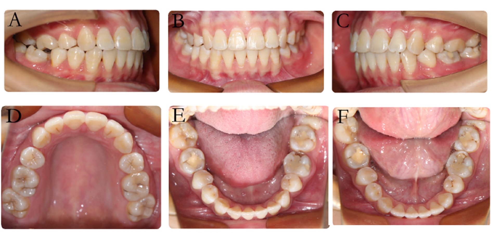 Journal of Clinical Pediatric Dentistry (JOCPD)