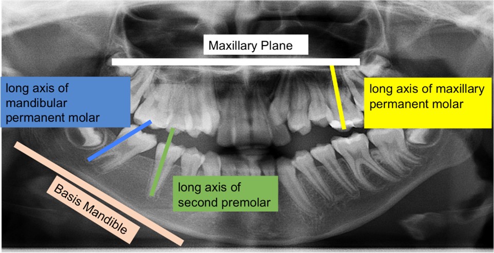 Journal of Clinical Pediatric Dentistry (JOCPD)
