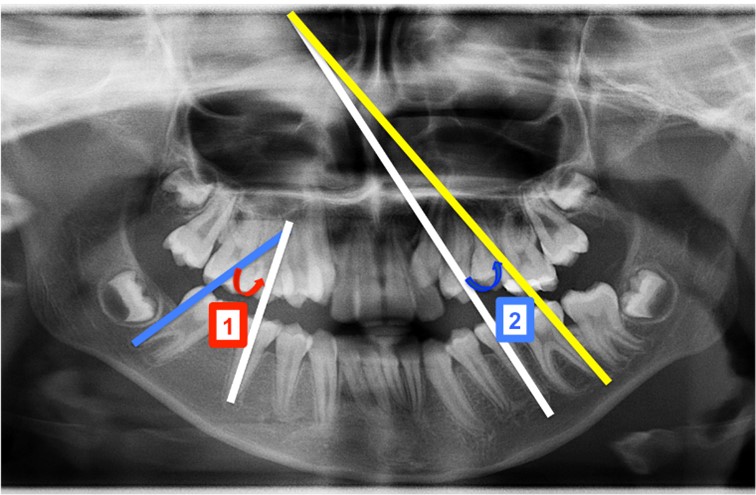 Journal of Clinical Pediatric Dentistry (JOCPD)
