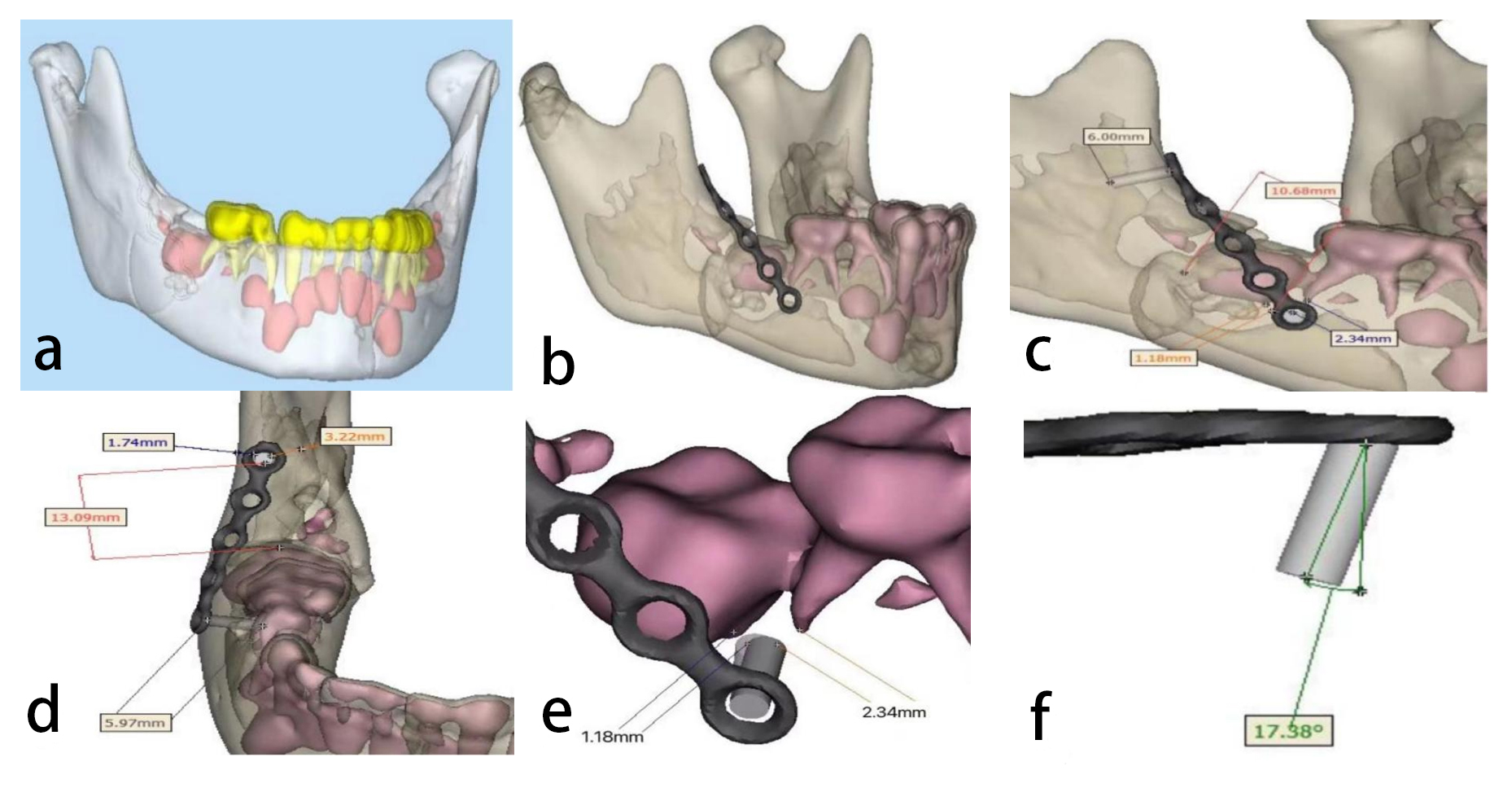 Journal of Clinical Pediatric Dentistry (JOCPD)
