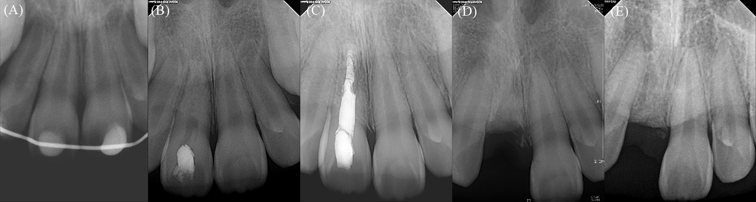 Journal of Clinical Pediatric Dentistry (JOCPD)