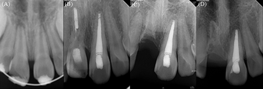 Journal of Clinical Pediatric Dentistry (JOCPD)