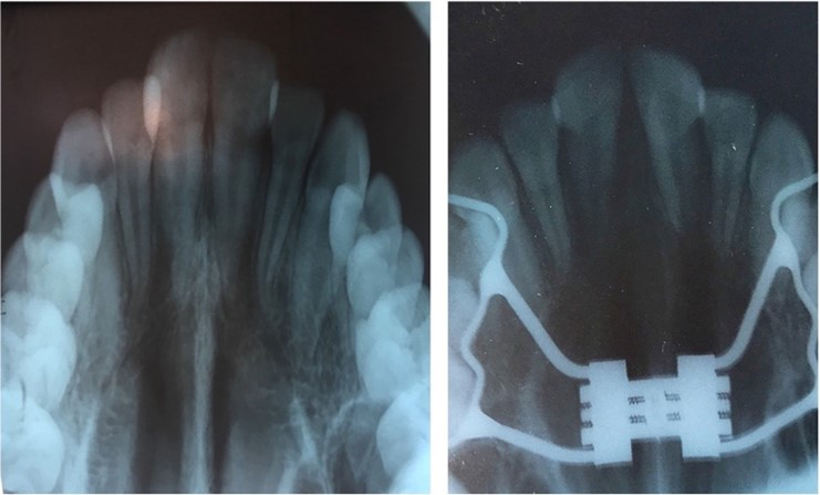 Journal of Clinical Pediatric Dentistry (JOCPD)