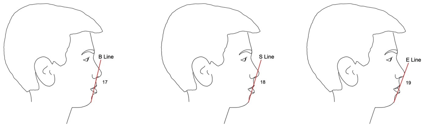 Journal of Clinical Pediatric Dentistry (JOCPD)