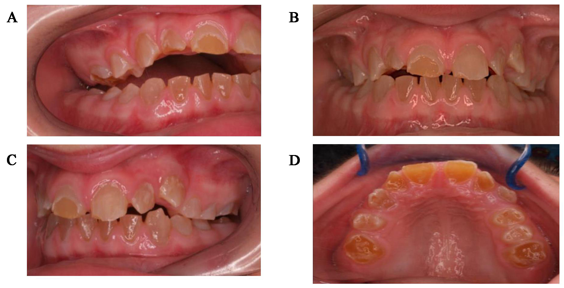Journal of Clinical Pediatric Dentistry (JOCPD)