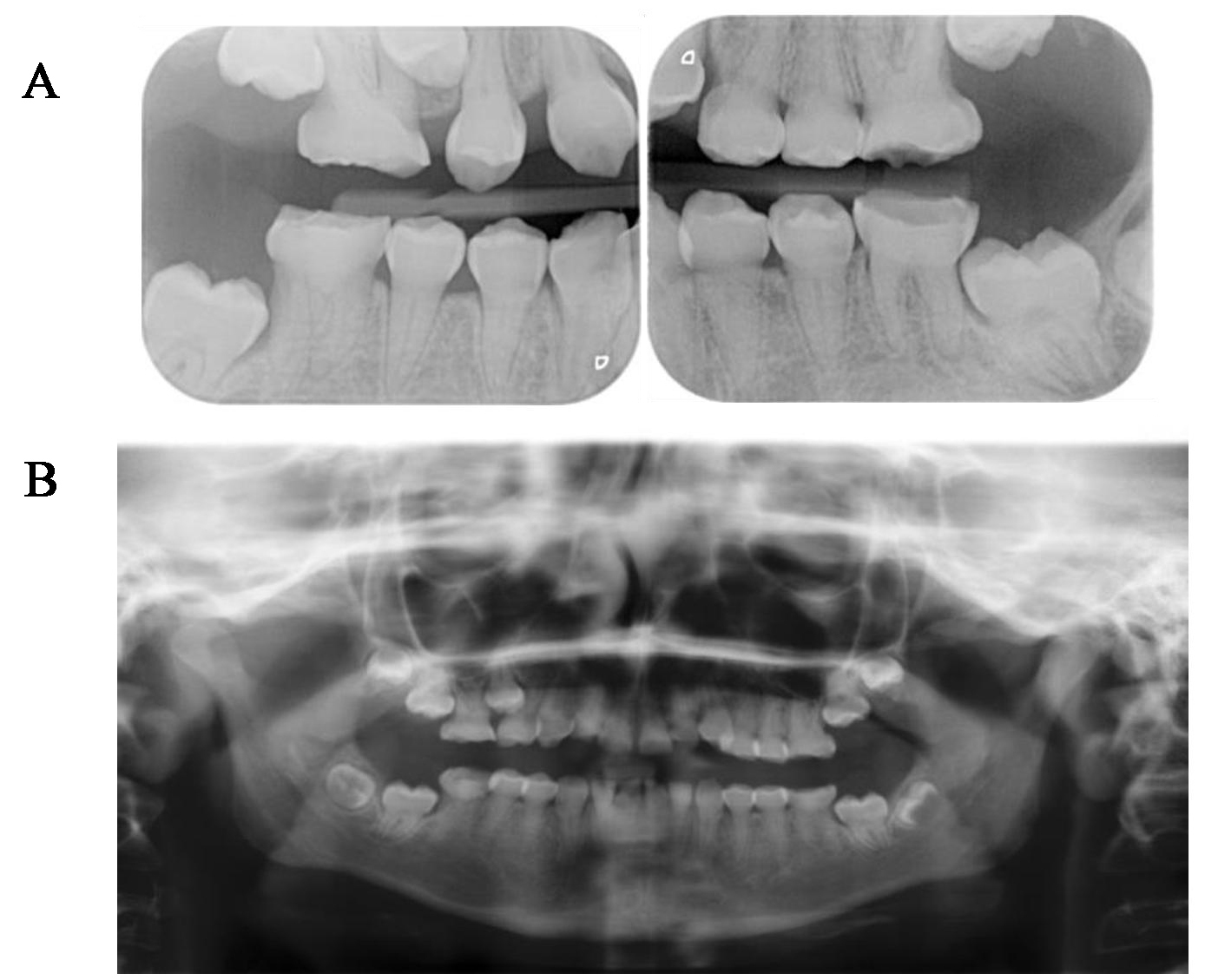 Journal of Clinical Pediatric Dentistry (JOCPD)