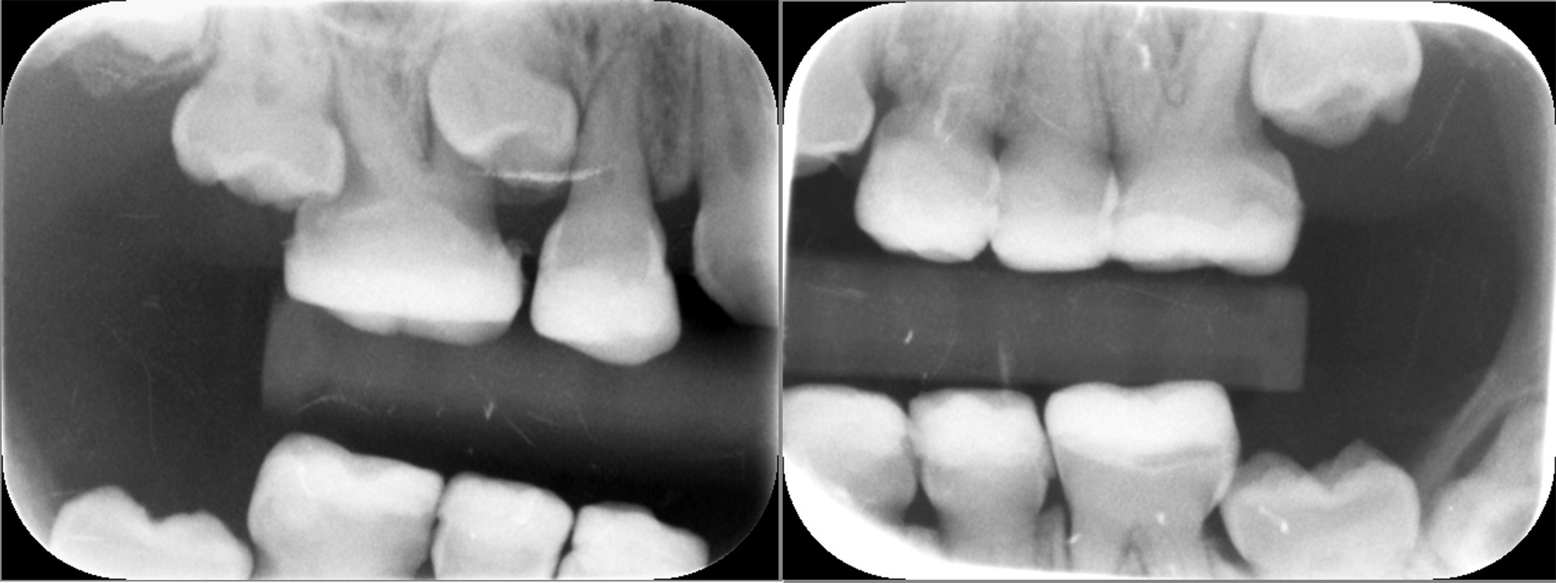 Journal of Clinical Pediatric Dentistry (JOCPD)