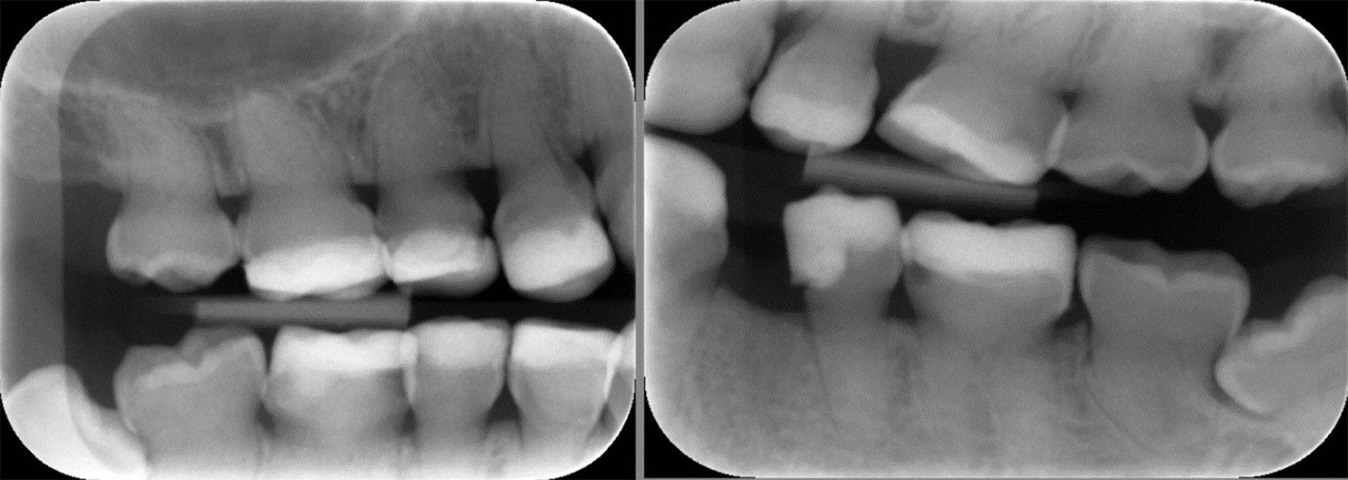 Journal of Clinical Pediatric Dentistry (JOCPD)