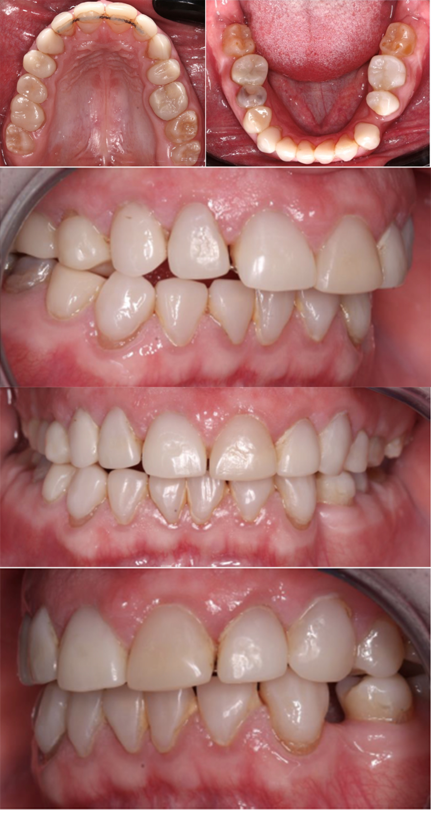 Journal of Clinical Pediatric Dentistry (JOCPD)