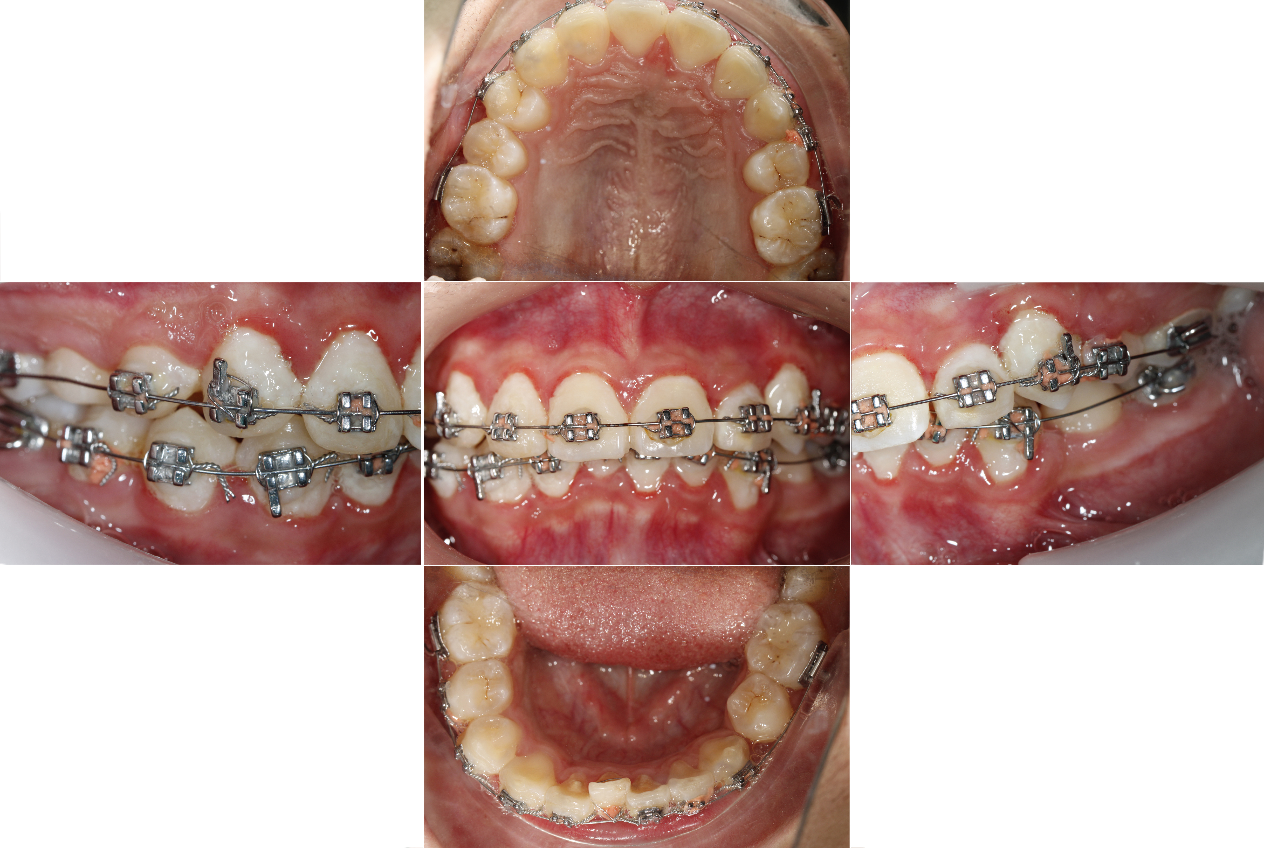 Journal of Clinical Pediatric Dentistry (JOCPD)