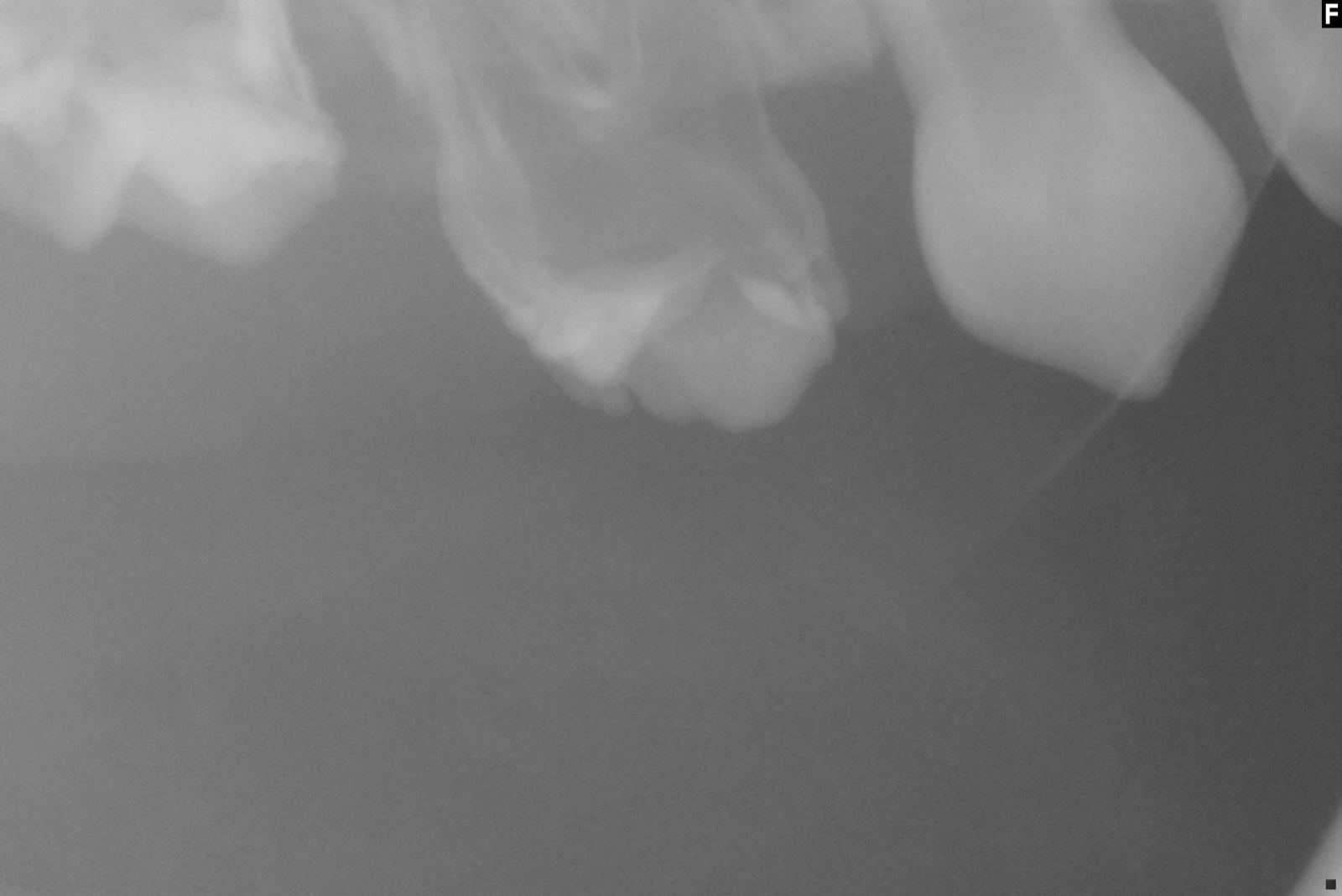 Journal of Clinical Pediatric Dentistry (JOCPD)