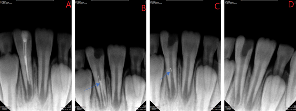 Journal of Clinical Pediatric Dentistry (JOCPD)