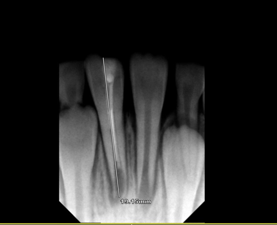 Journal of Clinical Pediatric Dentistry (JOCPD)