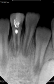 Journal of Clinical Pediatric Dentistry (JOCPD)