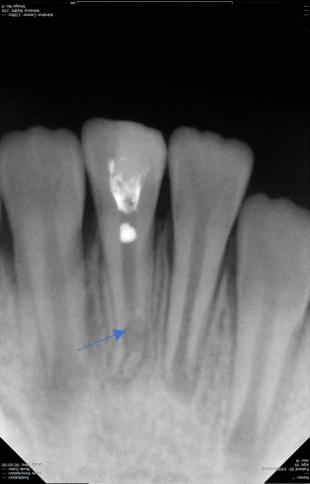 Journal of Clinical Pediatric Dentistry (JOCPD)
