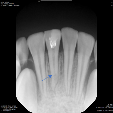 Journal of Clinical Pediatric Dentistry (JOCPD)