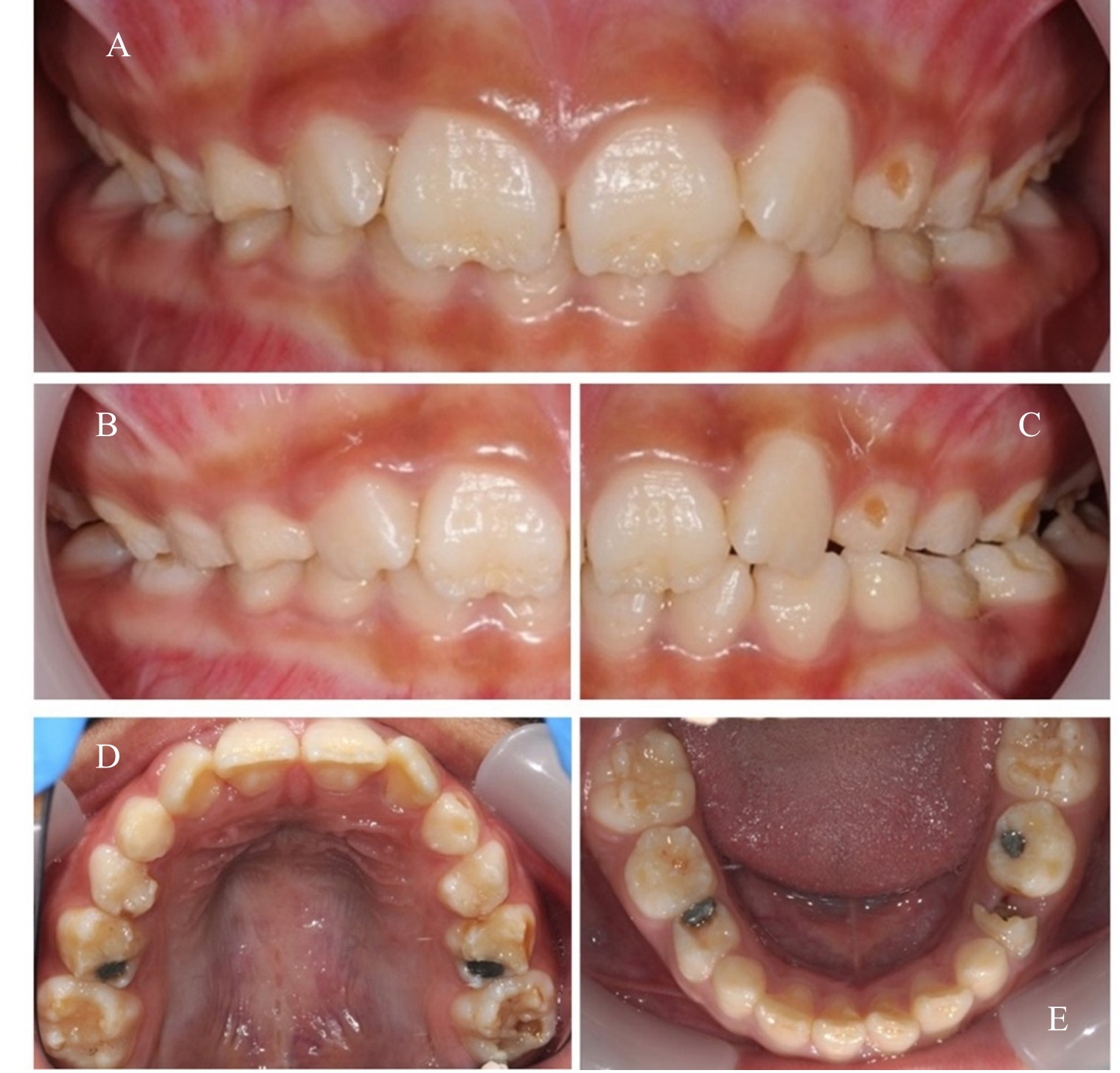 Journal of Clinical Pediatric Dentistry (JOCPD)