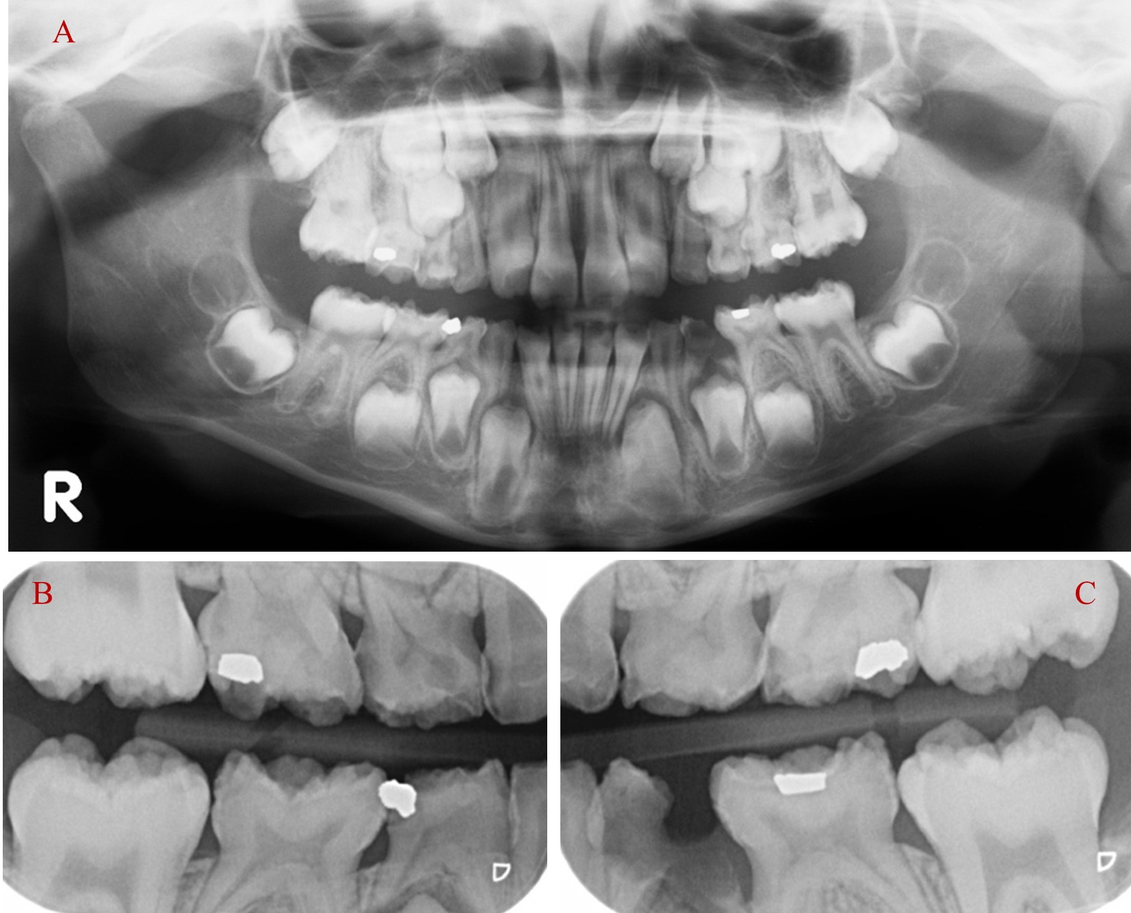 Journal of Clinical Pediatric Dentistry (JOCPD)