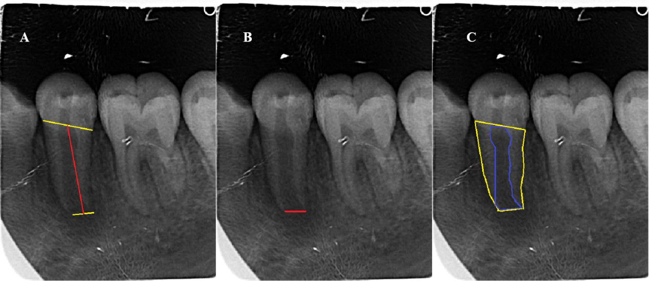 Journal of Clinical Pediatric Dentistry (JOCPD)
