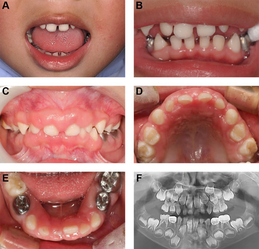 Journal of Clinical Pediatric Dentistry (JOCPD)