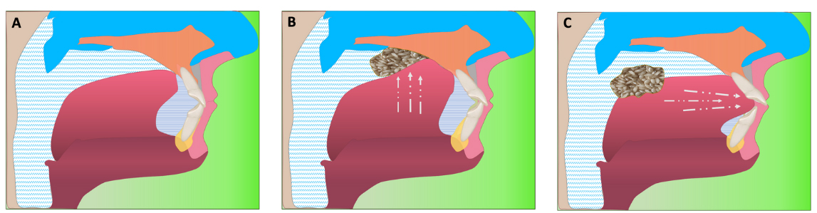 Journal of Clinical Pediatric Dentistry (JOCPD)