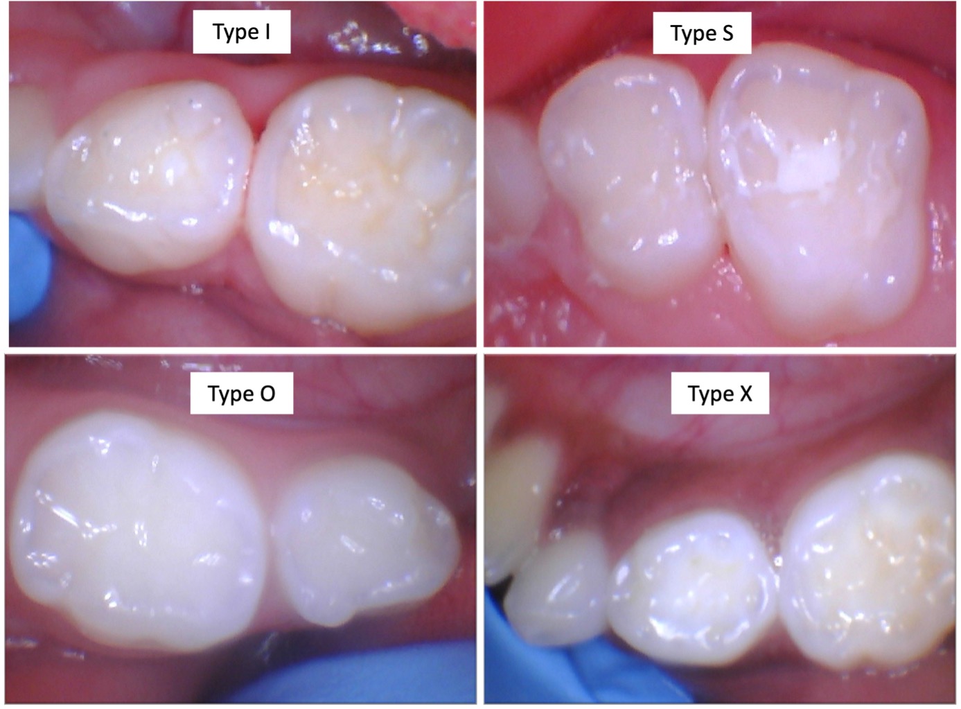 Journal of Clinical Pediatric Dentistry (JOCPD)