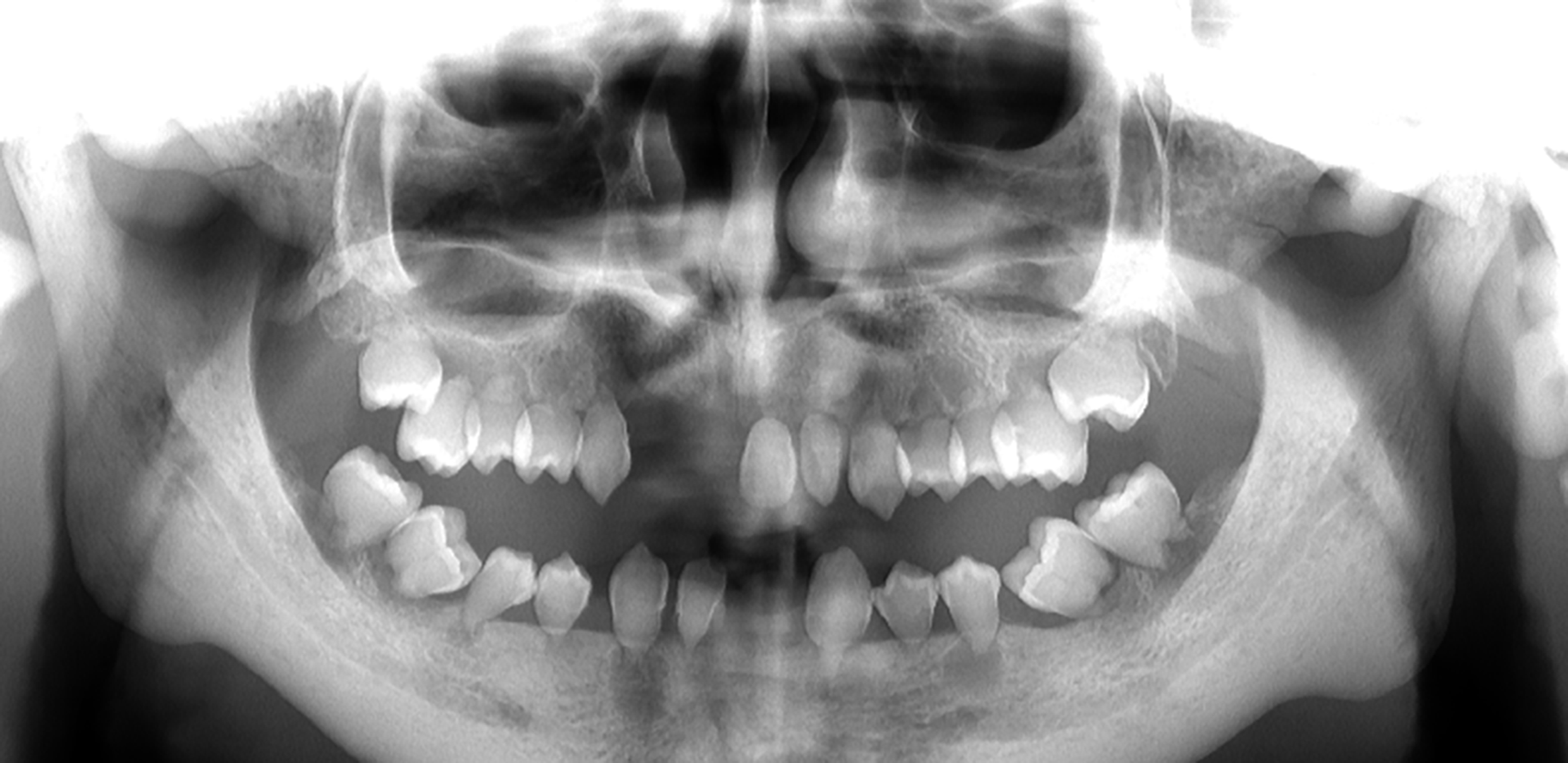 Journal of Clinical Pediatric Dentistry (JOCPD)