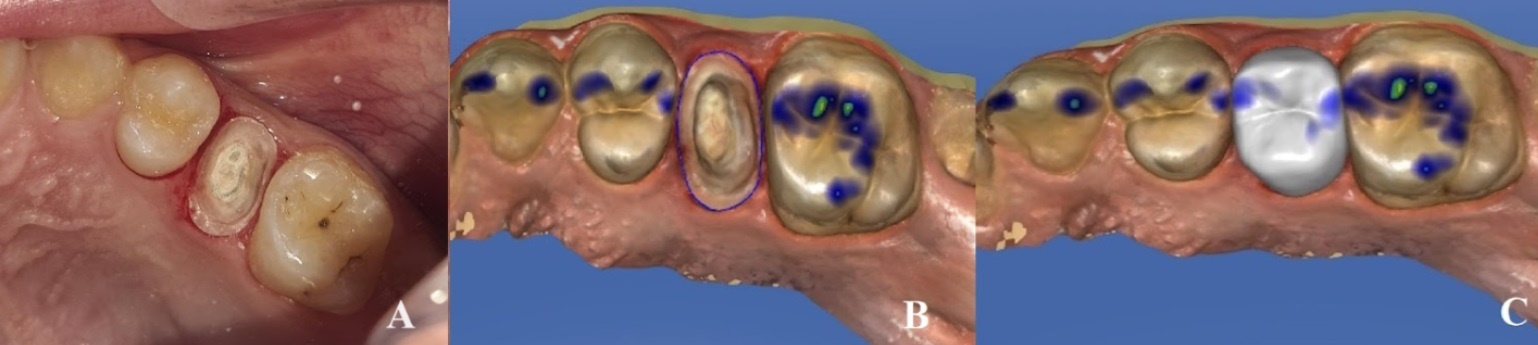 Journal of Clinical Pediatric Dentistry (JOCPD)