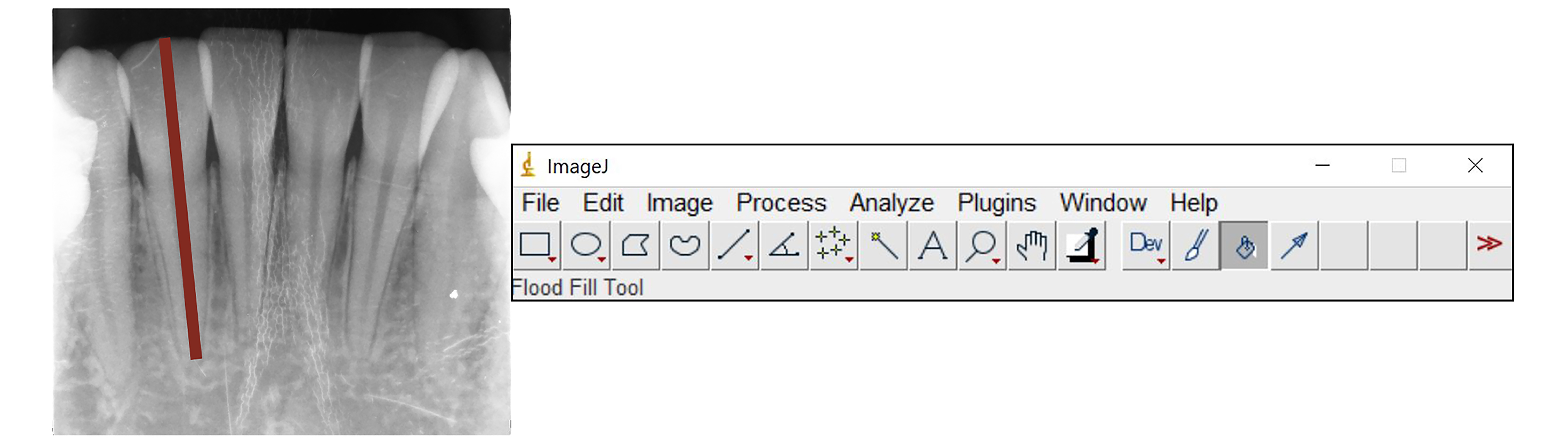 Journal of Clinical Pediatric Dentistry (JOCPD)