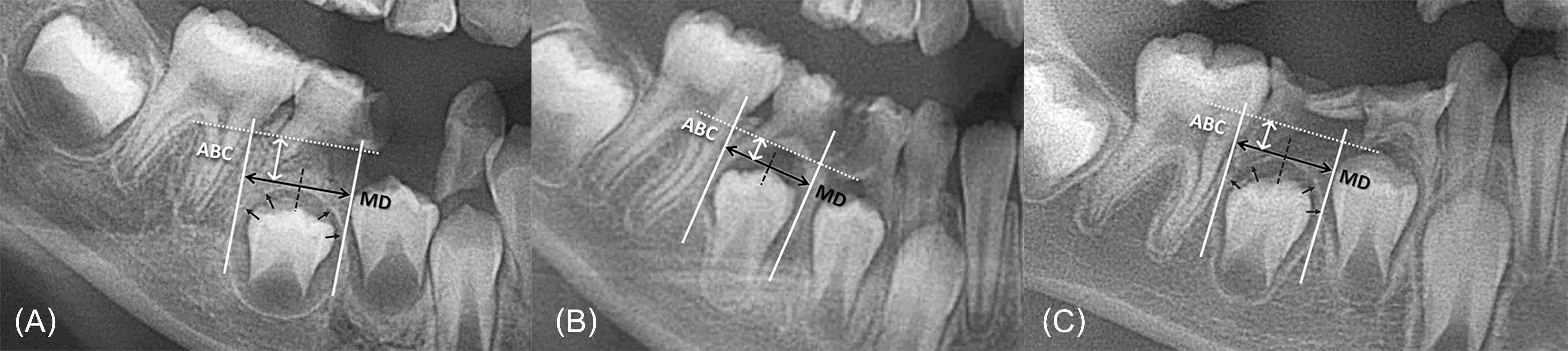 Journal of Clinical Pediatric Dentistry (JOCPD)