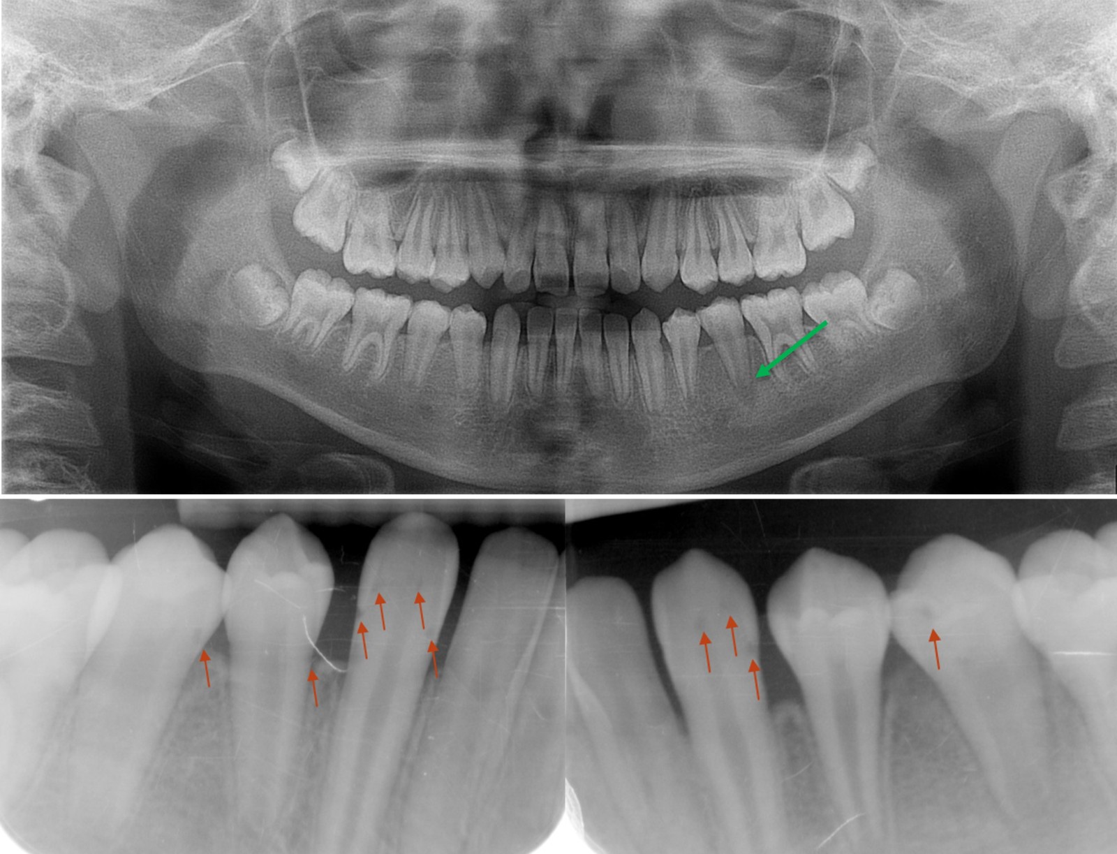Journal of Clinical Pediatric Dentistry (JOCPD)
