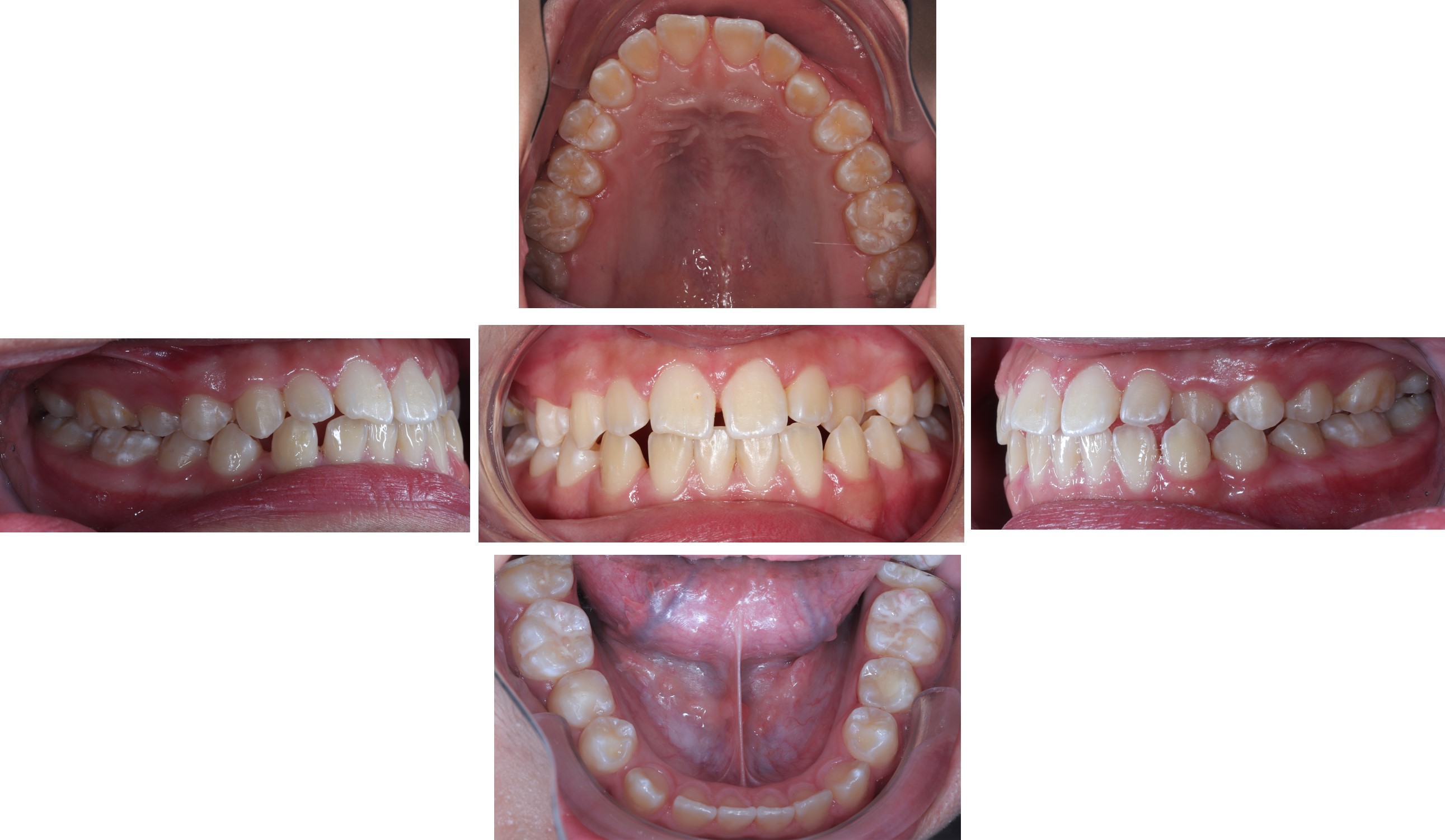 Journal of Clinical Pediatric Dentistry (JOCPD)