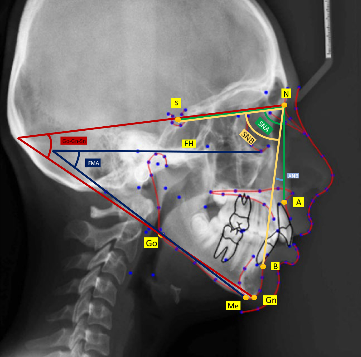 Journal of Clinical Pediatric Dentistry (JOCPD)