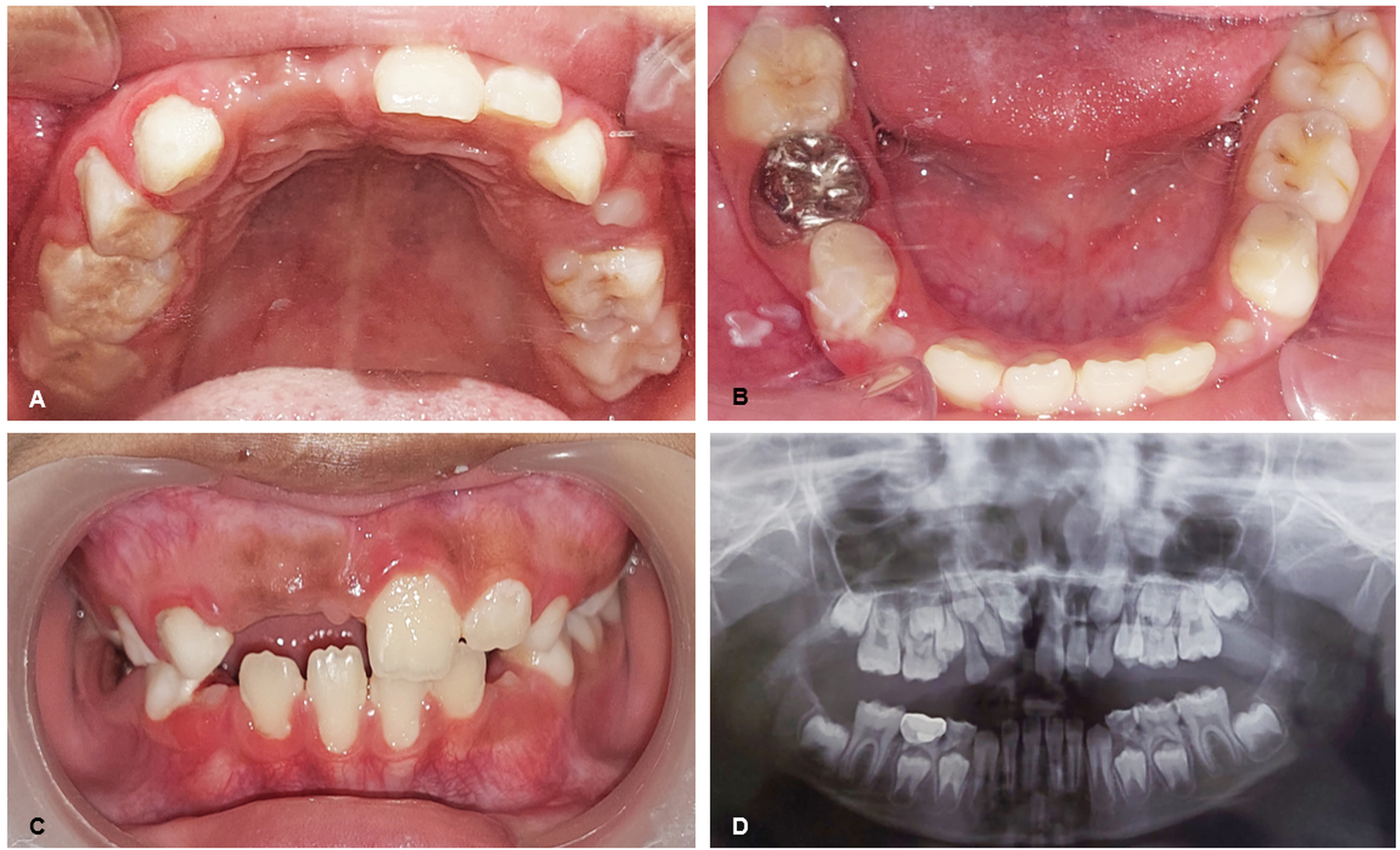 Journal of Clinical Pediatric Dentistry (JOCPD)