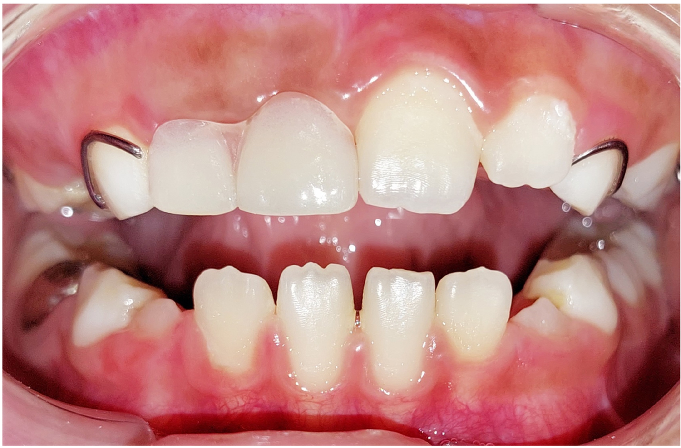 Journal of Clinical Pediatric Dentistry (JOCPD)