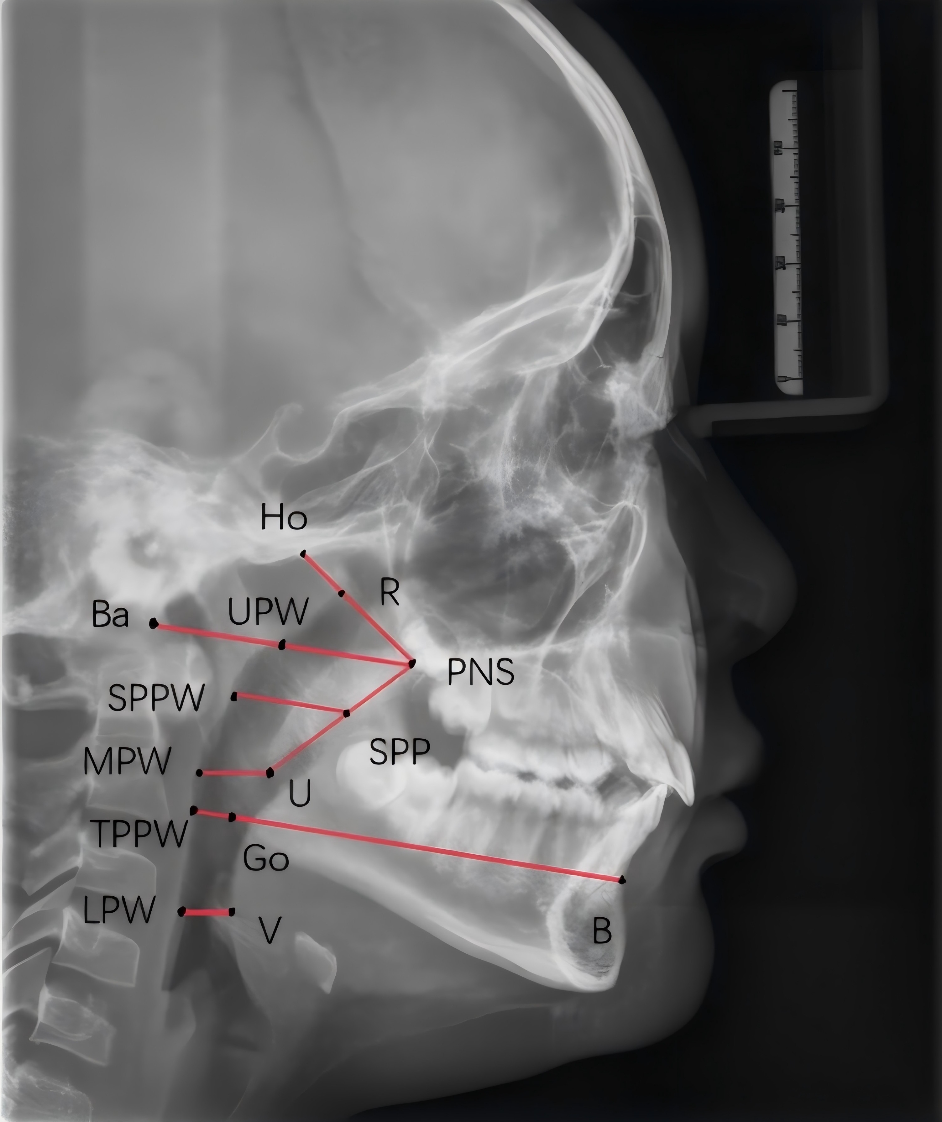 Journal of Clinical Pediatric Dentistry (JOCPD)