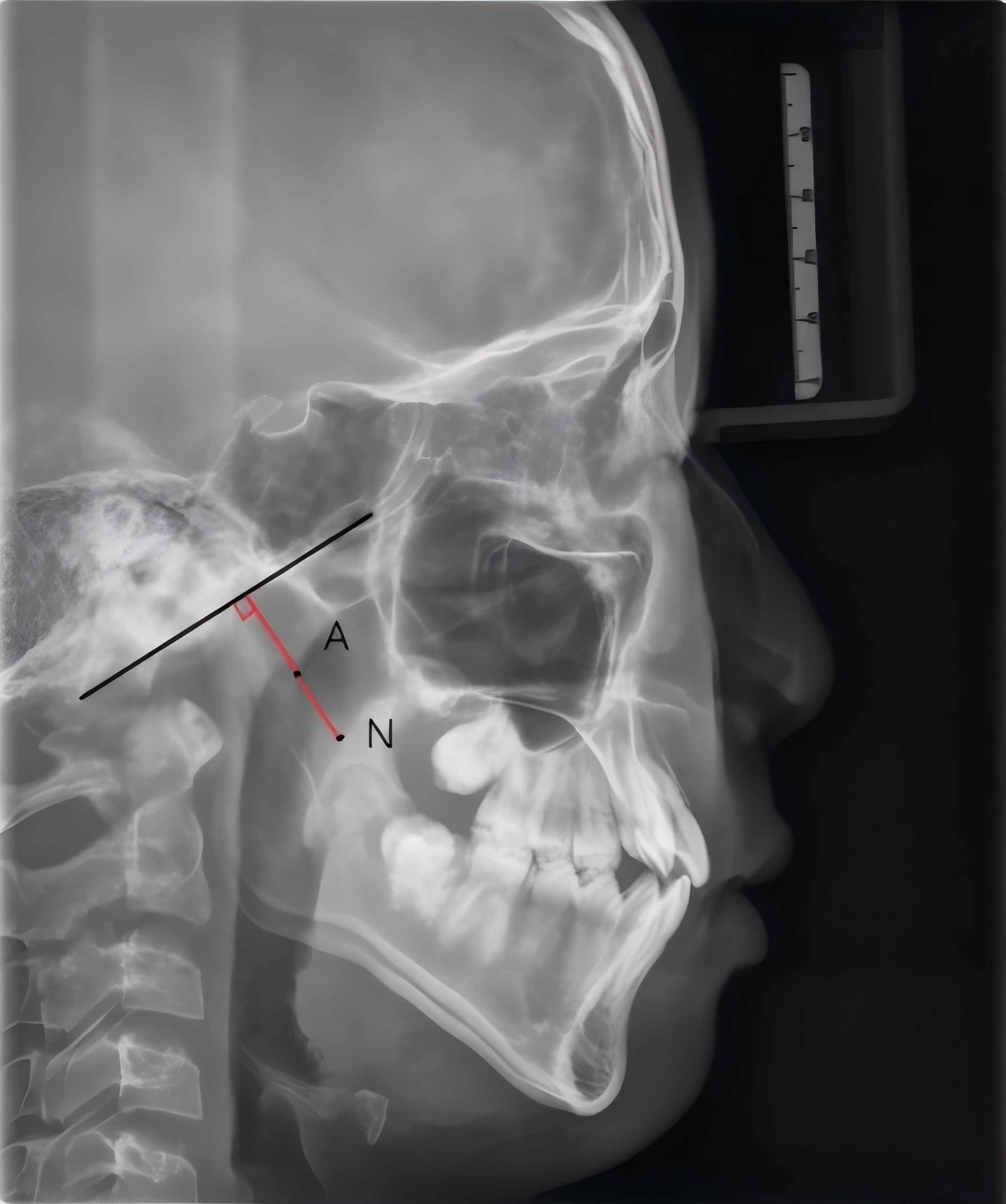 Journal of Clinical Pediatric Dentistry (JOCPD)