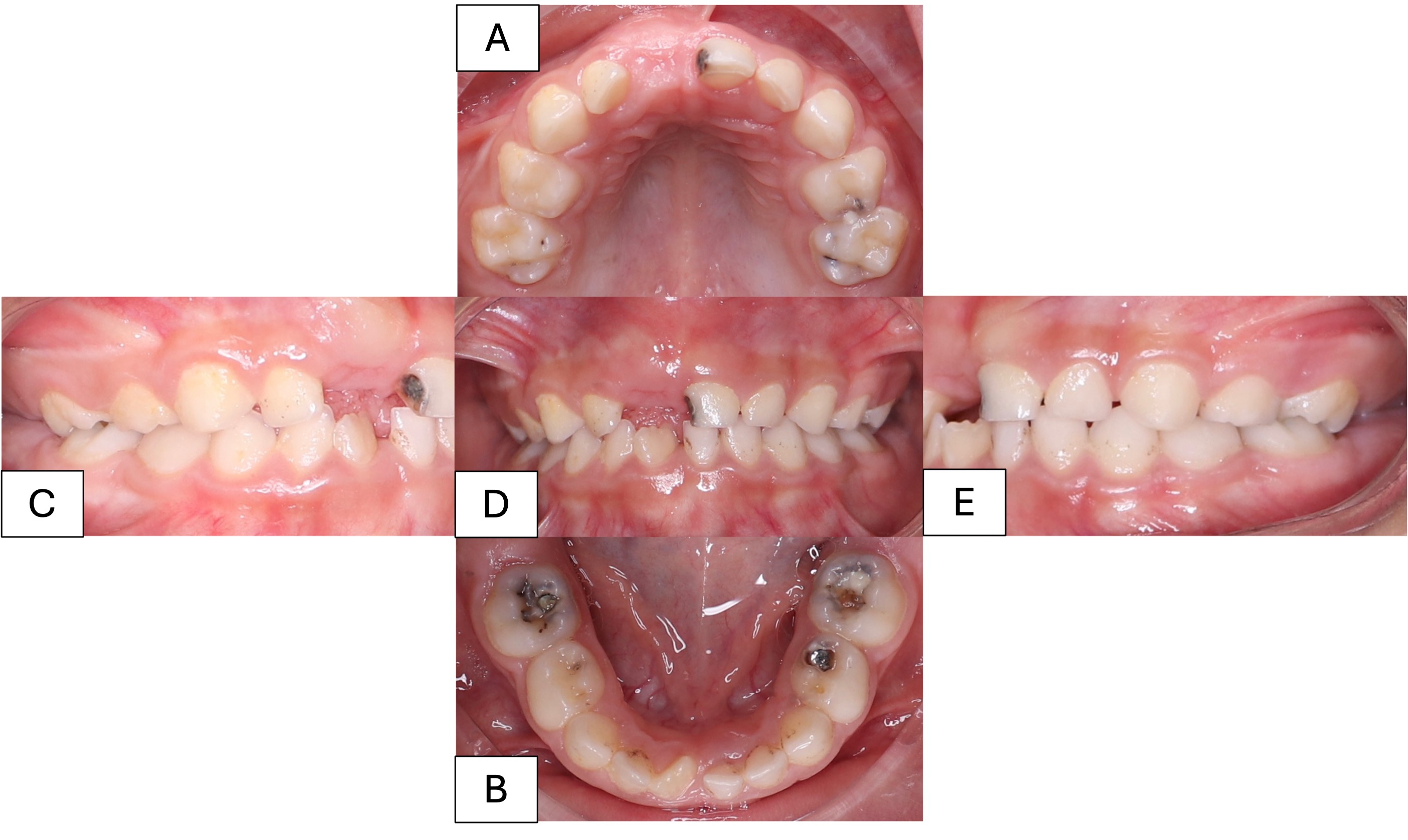 Journal of Clinical Pediatric Dentistry (JOCPD)