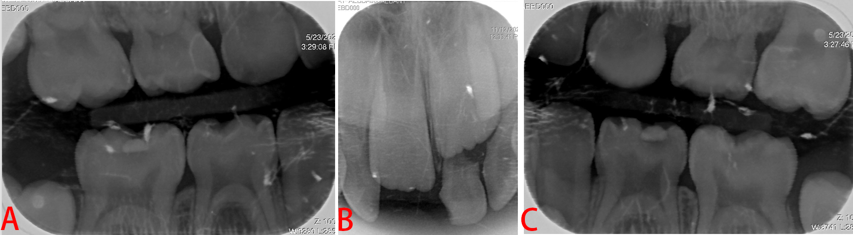 Journal of Clinical Pediatric Dentistry (JOCPD)