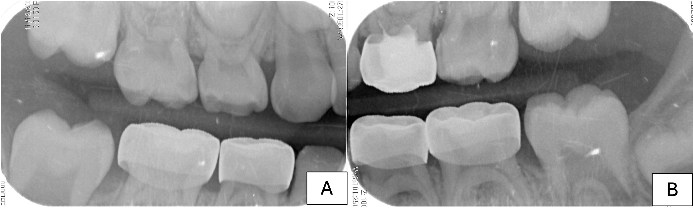 Journal of Clinical Pediatric Dentistry (JOCPD)