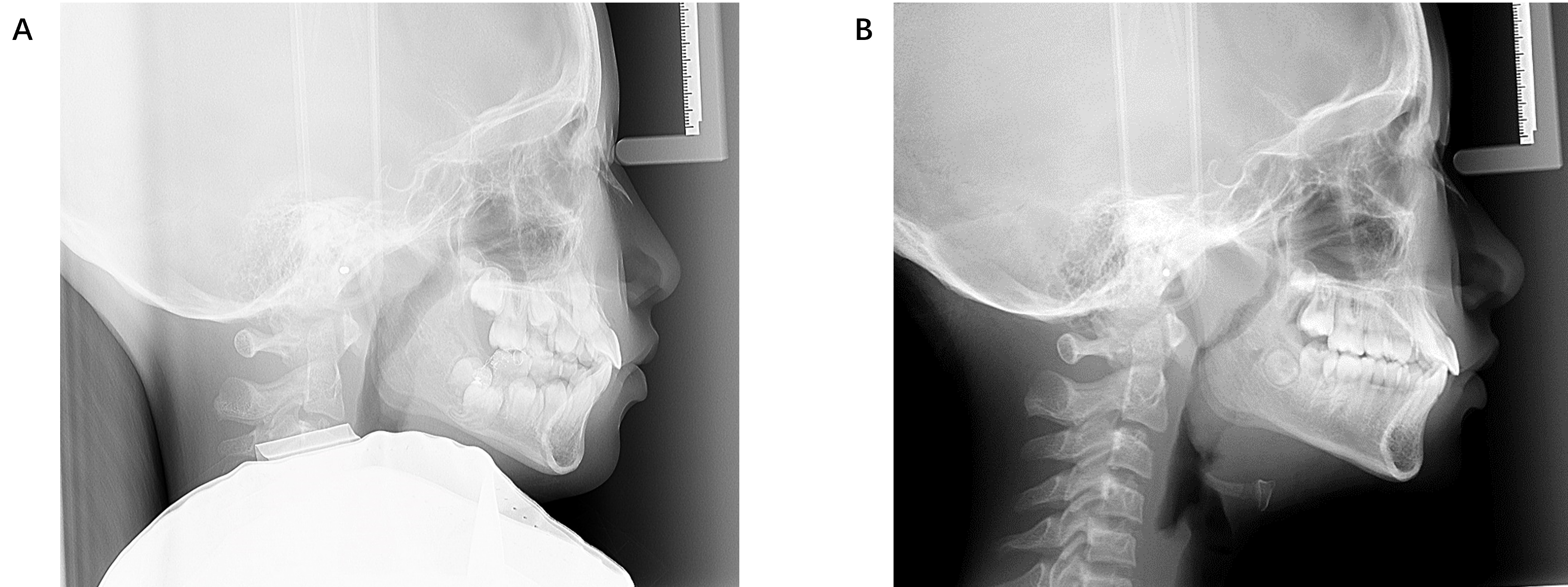 Journal of Clinical Pediatric Dentistry (JOCPD)