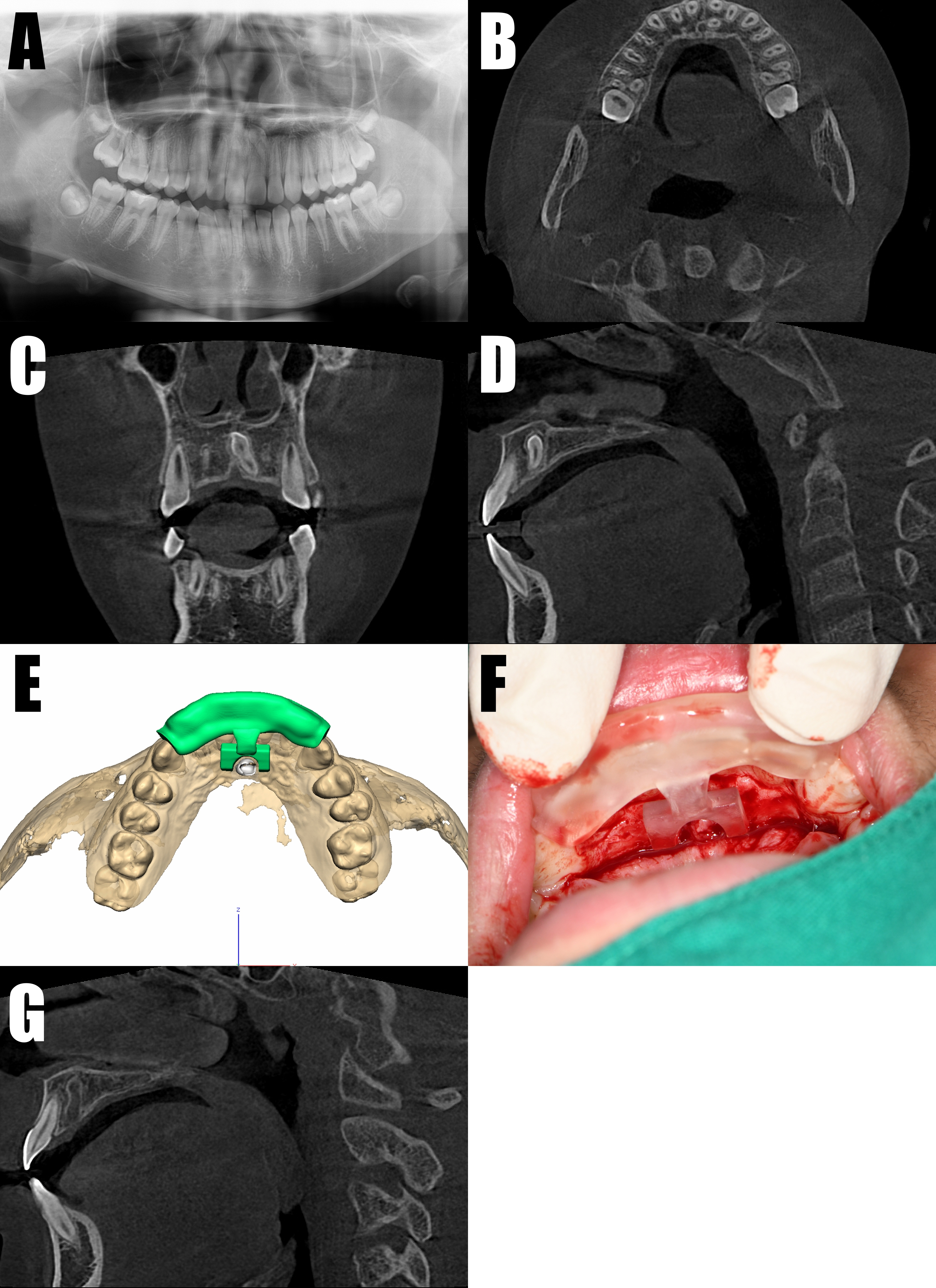 Journal of Clinical Pediatric Dentistry (JOCPD)