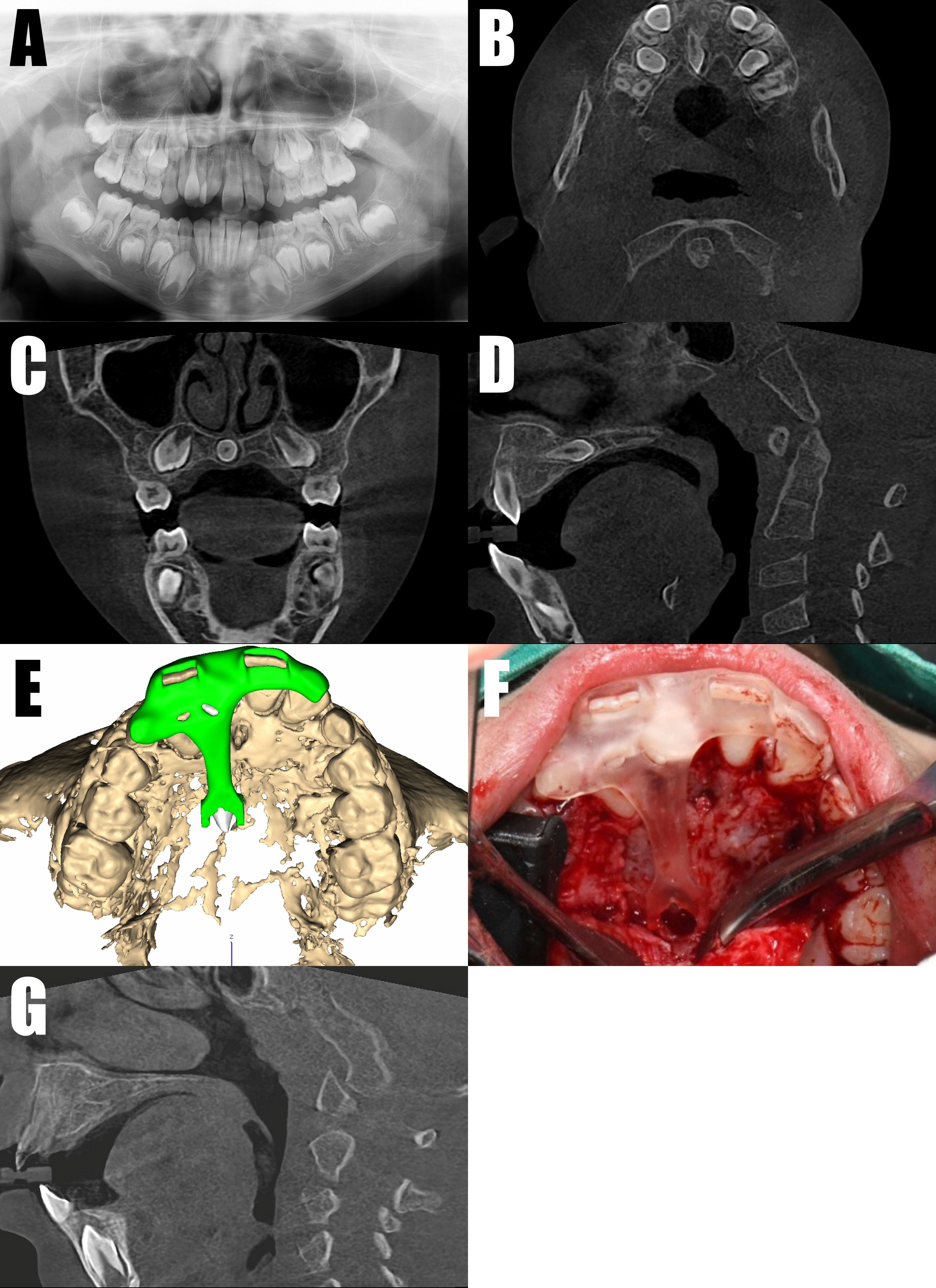 Journal of Clinical Pediatric Dentistry (JOCPD)